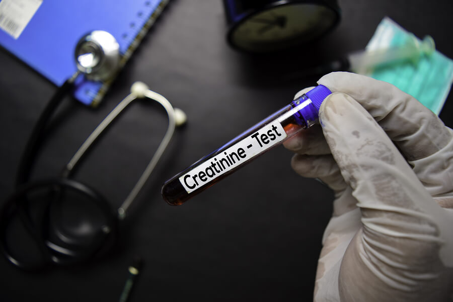 ¿Cuál es la importancia de la creatinina? - Eres Deportista